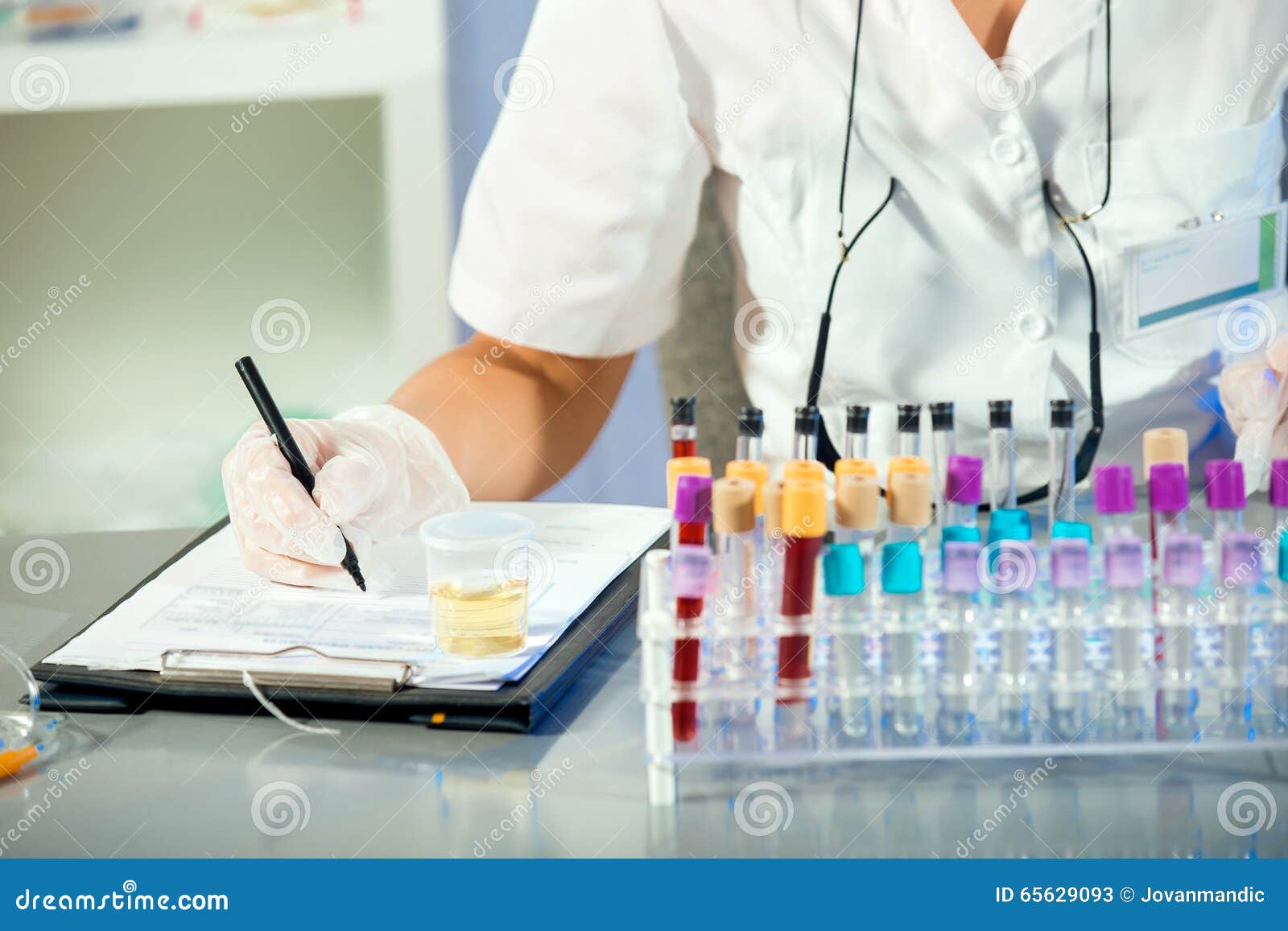 Reagenzglas mit Urinprobe stockbild. Bild von doktor - 65629093
