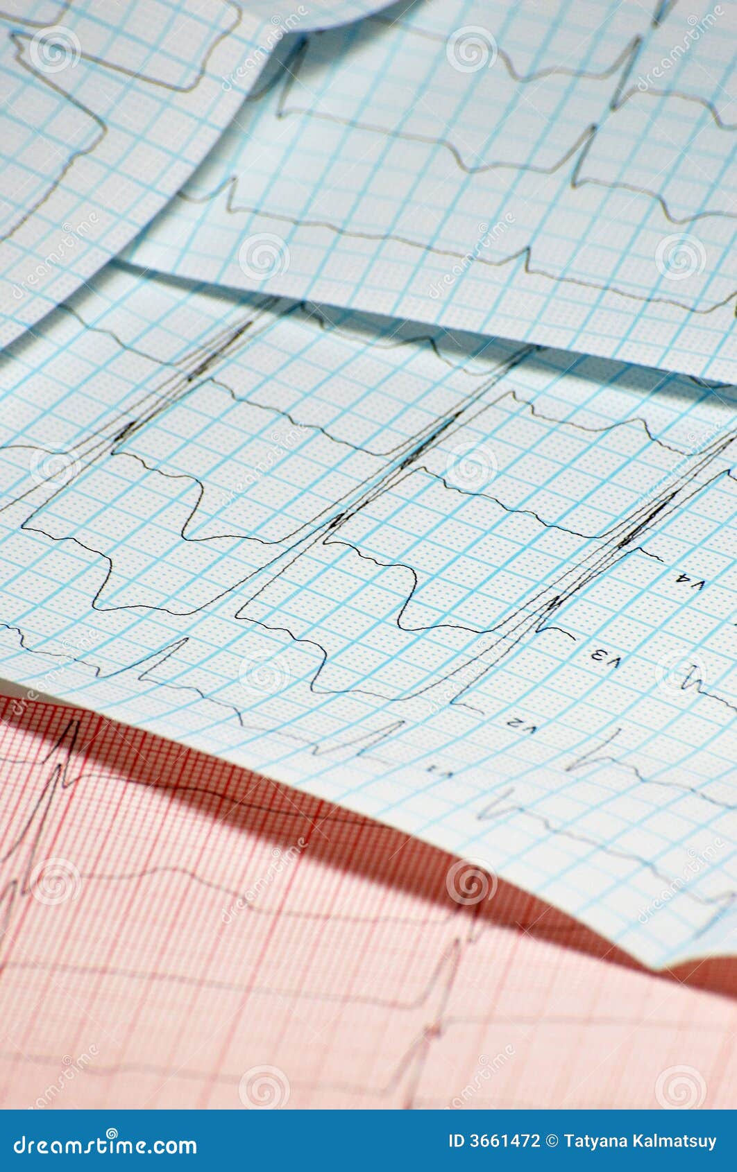 Real ECG stock photo. Image of artery, checkup, analyse - 3661472
