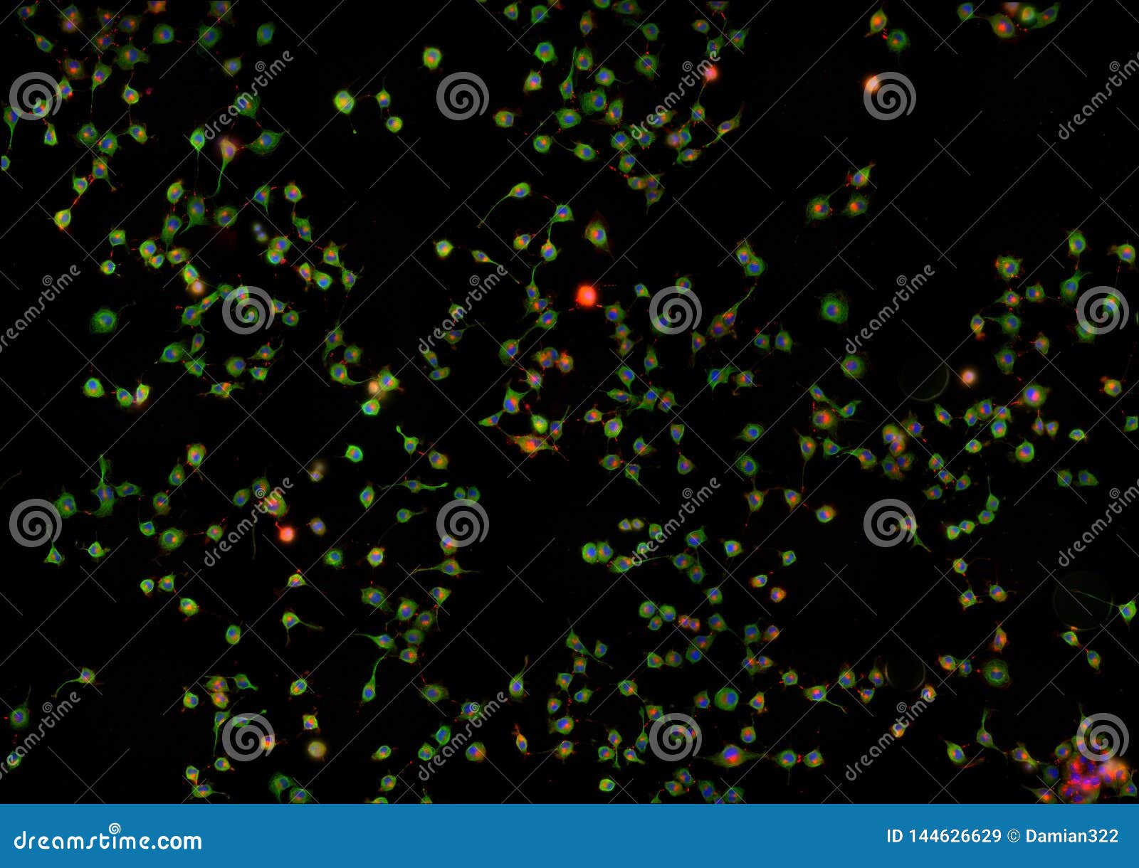 Real Fluorescence Microscopic View of Cancer Cells Stock Image - Image ...