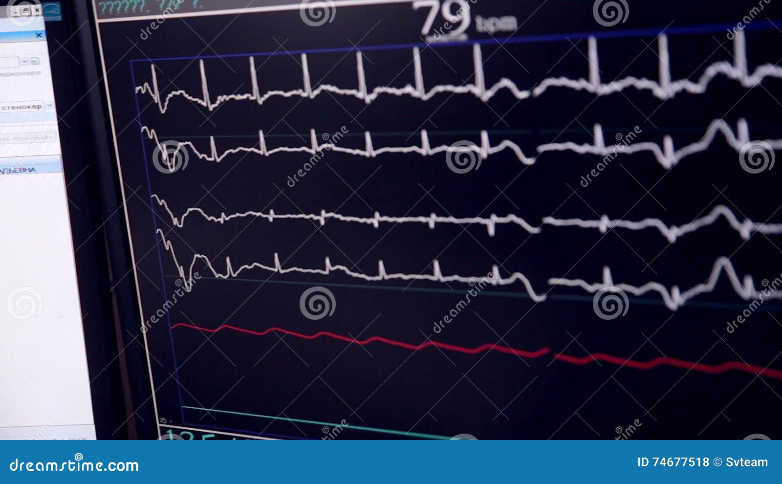 Real Heart beat pulse. stock footage. Video of graphic - 74677518