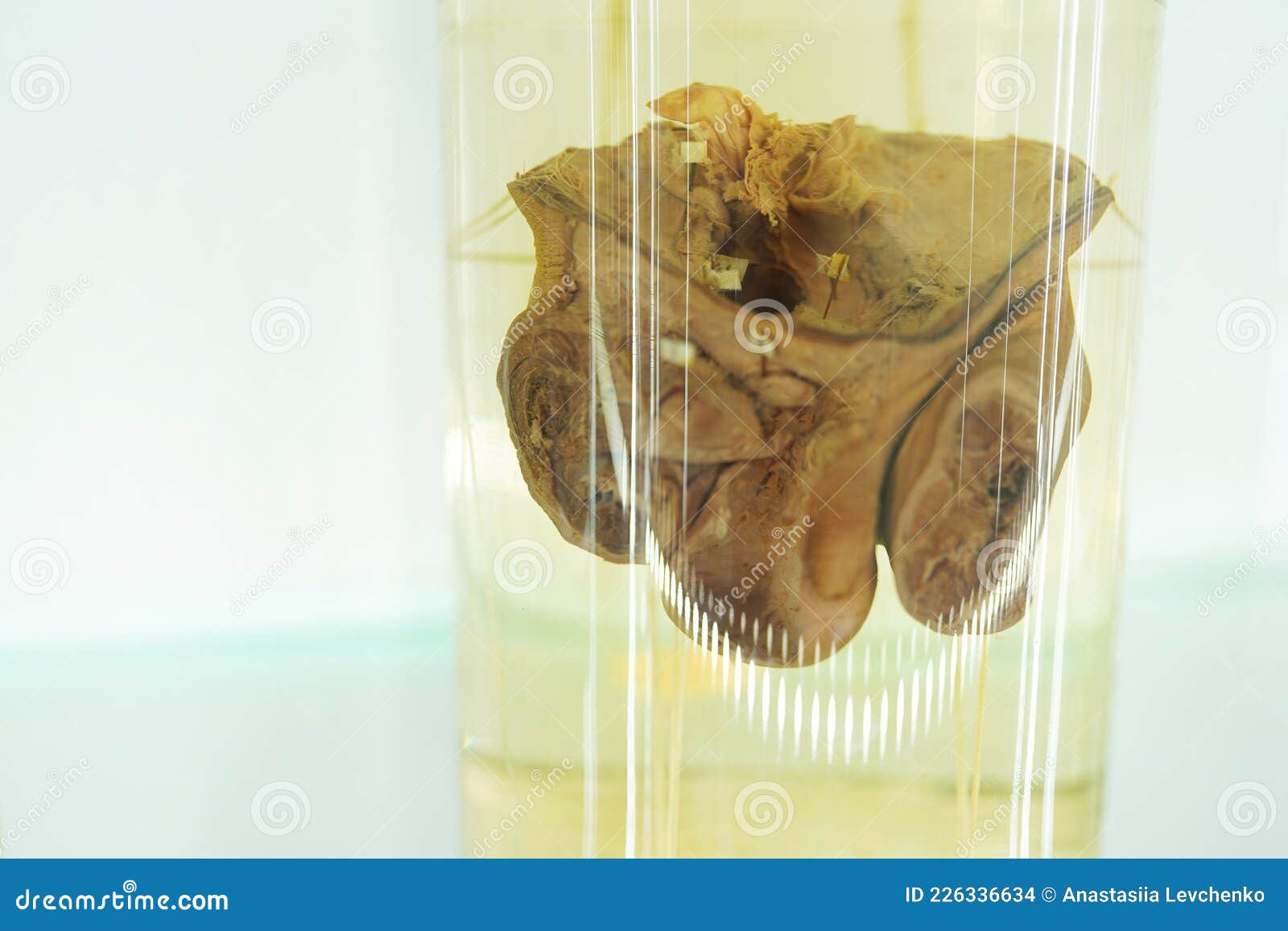 Real Human Lungs