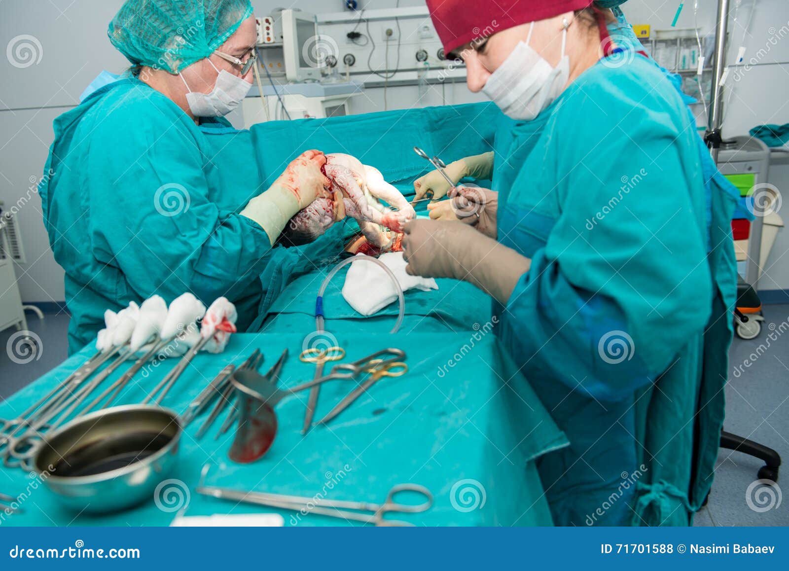 Real Operation for Cesarean Section Editorial Stock Photo - Image of ...