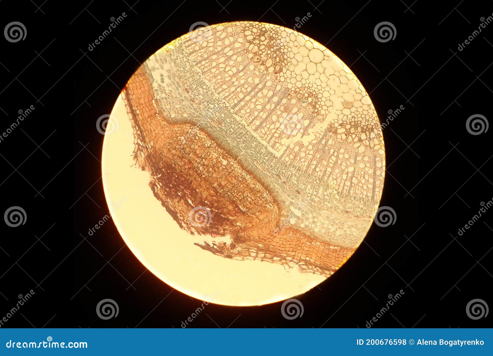 Real Photo of Plant Cells Lentil Under the Microscope Stock Photo ...