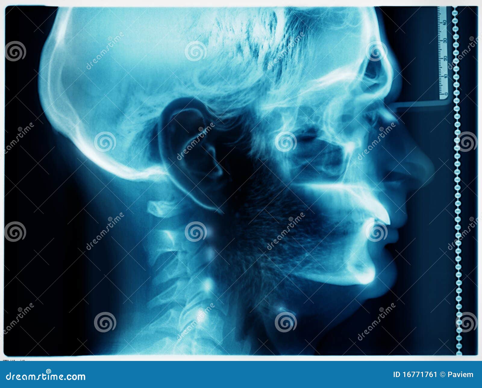 Real and X-ray view stock image. Image of vision, fitment - 16771761