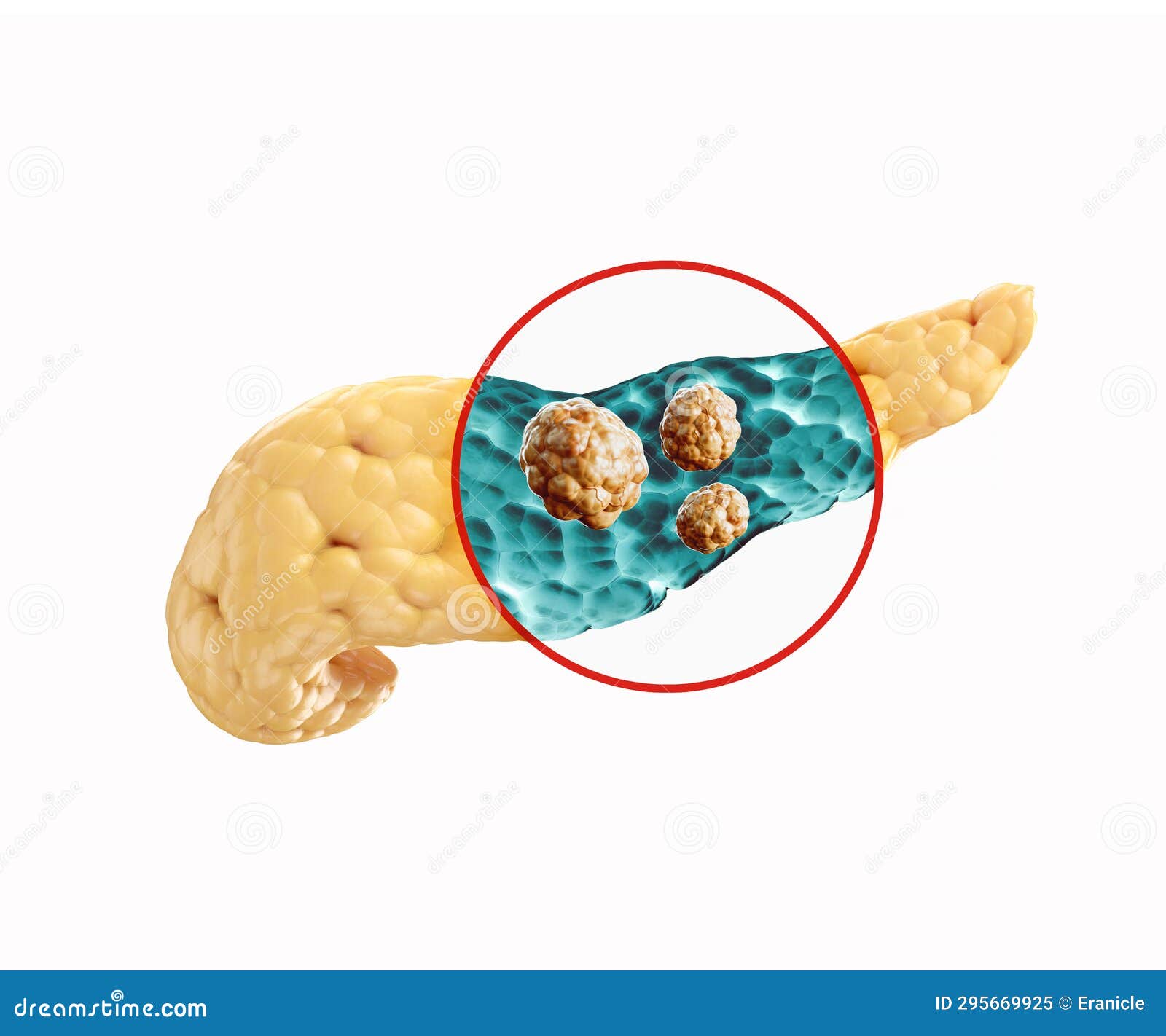 Realistic Pancreas. Secretion Of Digestive Juices And Hormones. Organ ...