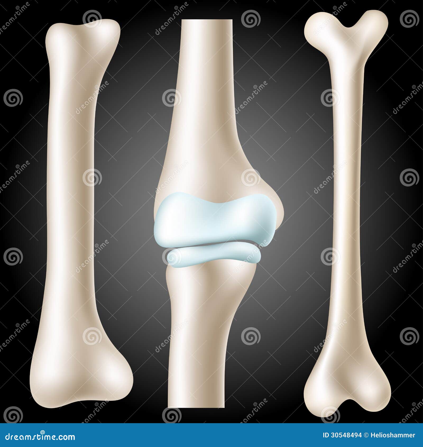 Realistic Bone Spongy Structure Close-up, Bone Texture Affected By ...