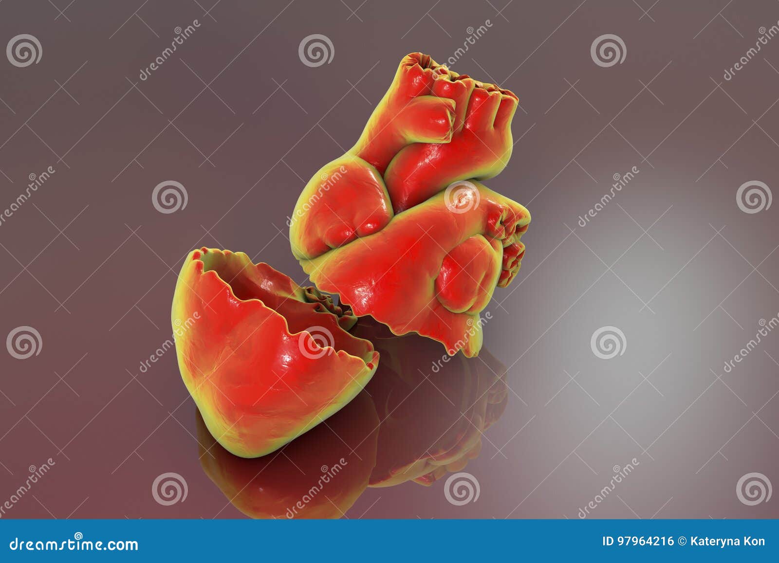 Realistic Broken Heart, Separation and Divorce Concept Stock ...
