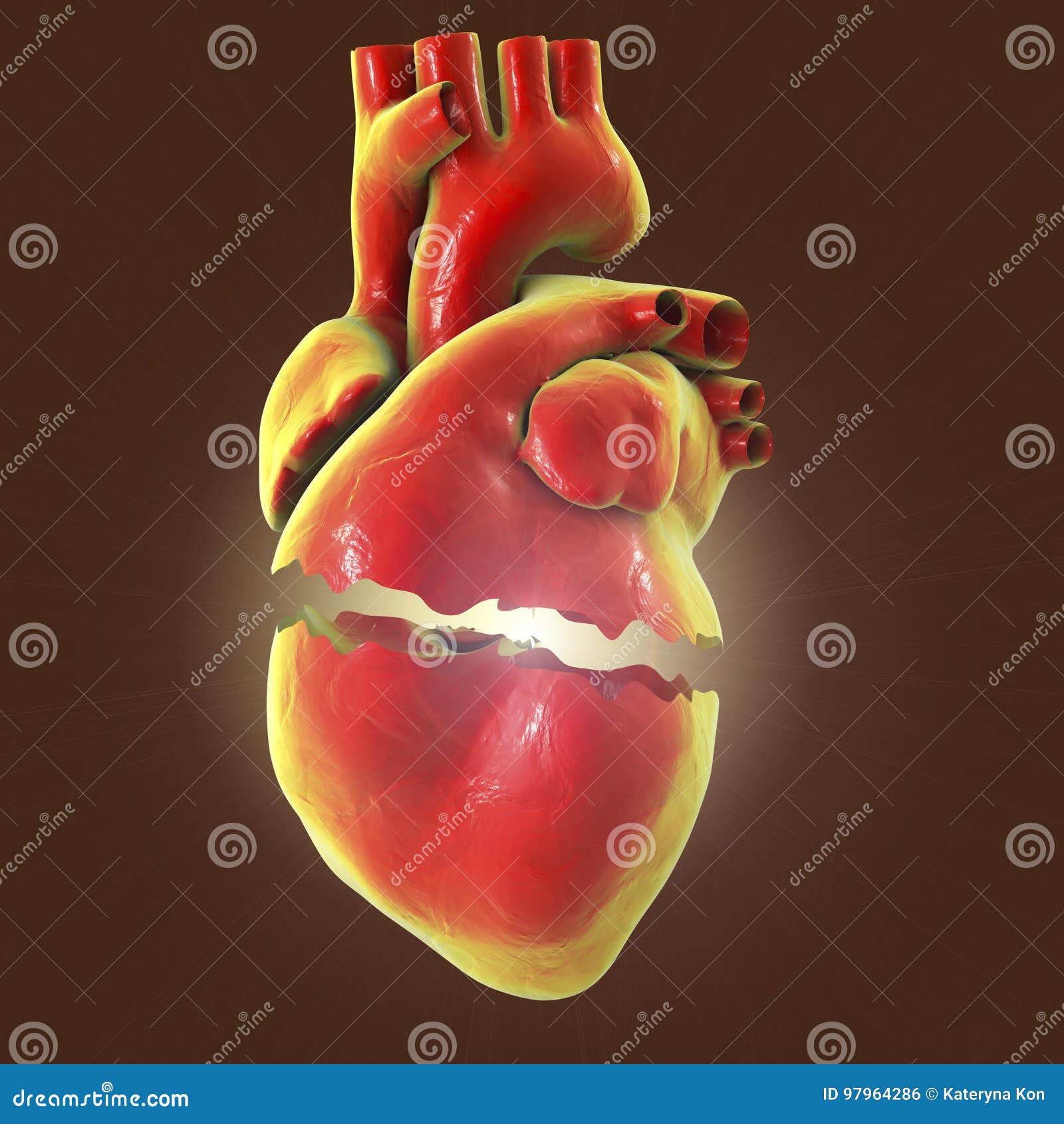 Realistic Broken Heart, Separation and Divorce Concept Stock ...