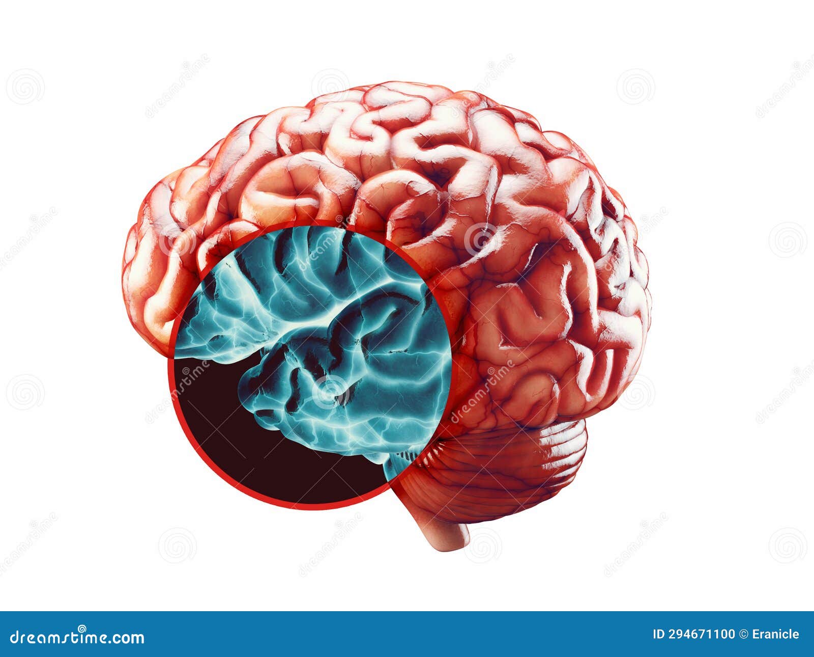 Realistic 3d Illustration of Human Brain with Blood Vessels Isolated ...