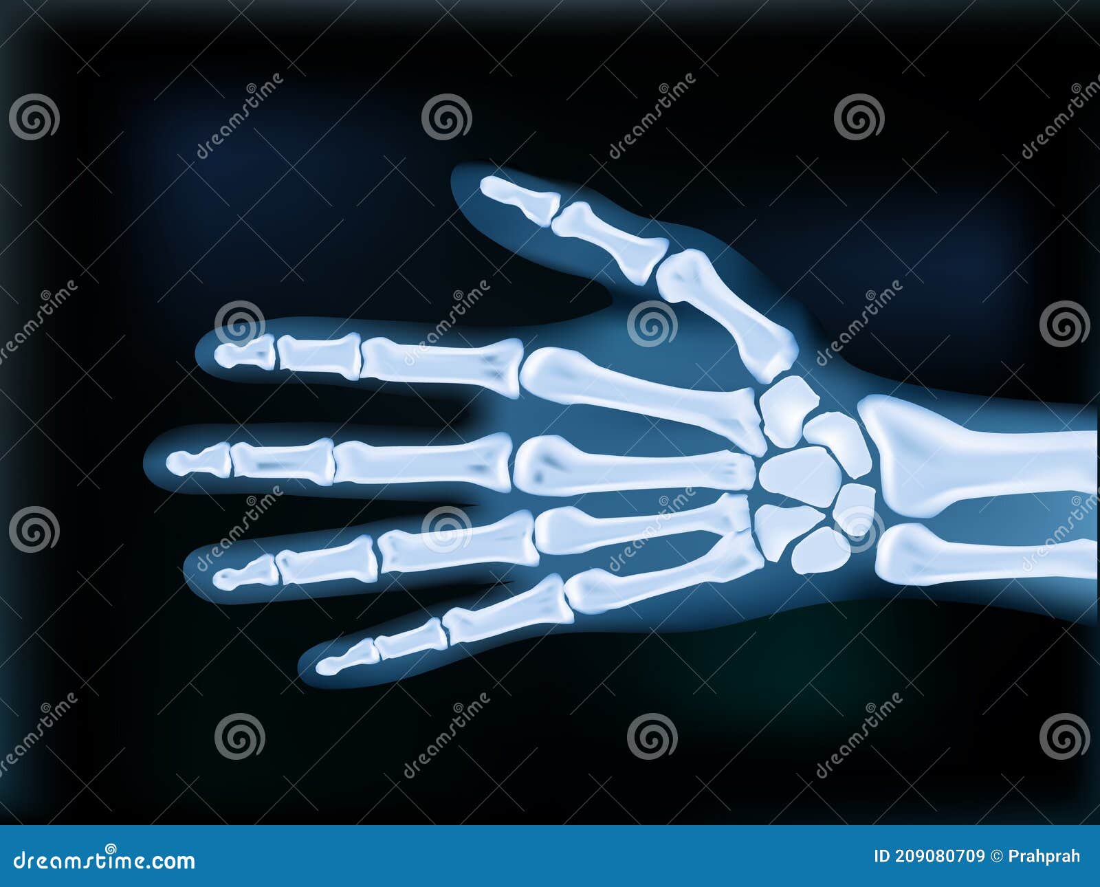 Realistic 2D X-ray Hand Dark Medical Image Stock Vector - Illustration ...