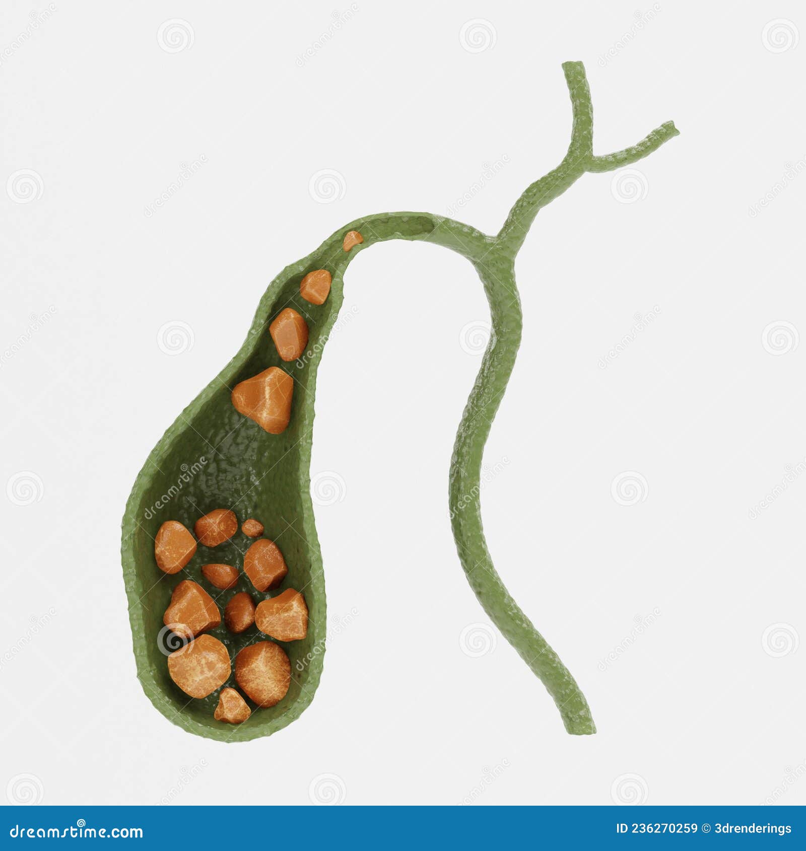 Gallbladder Cross Section Real Human Anatomy - On Blue Background ...