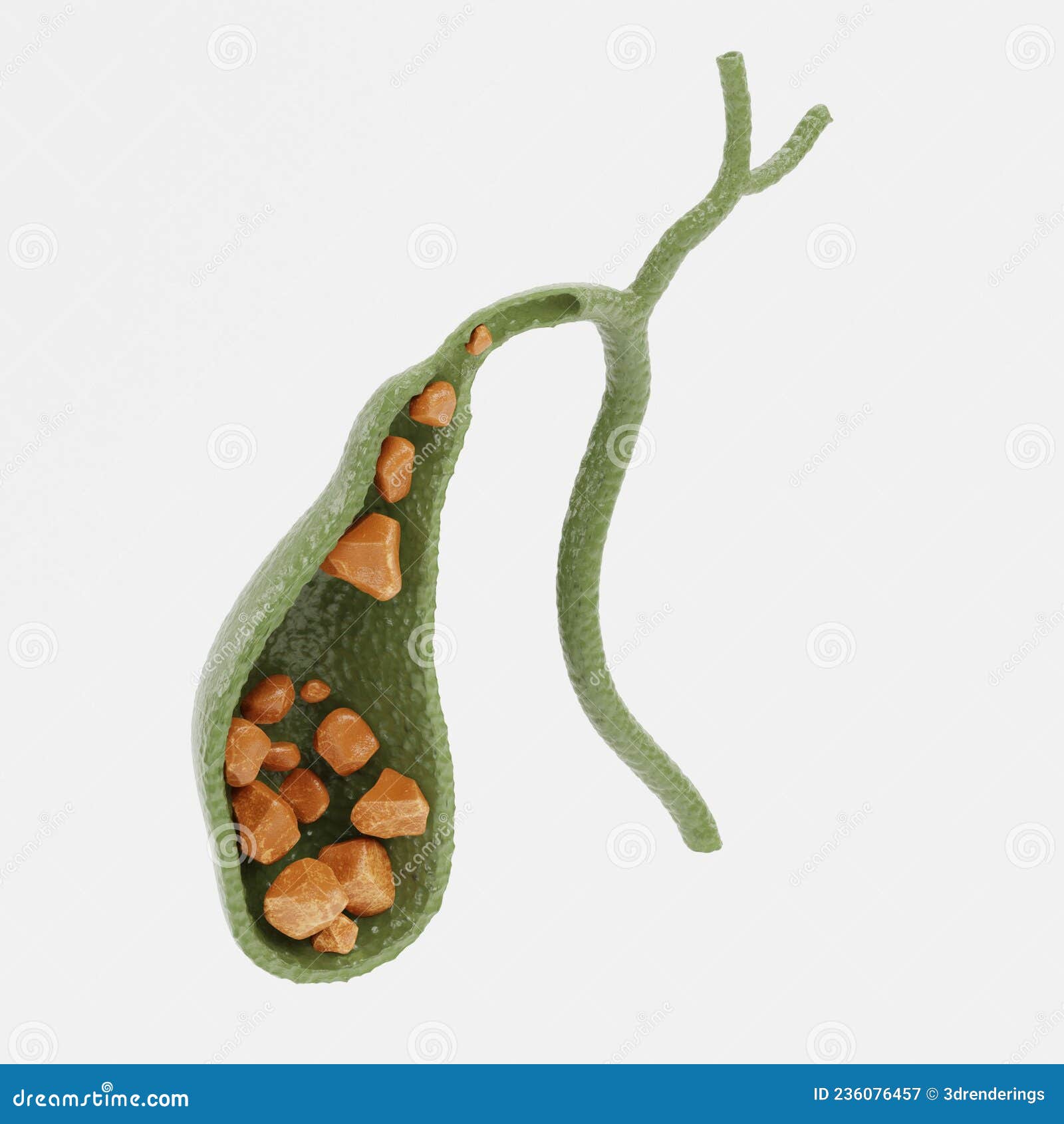 Gallbladder Cross Section Real Human Anatomy - On Blue Background ...