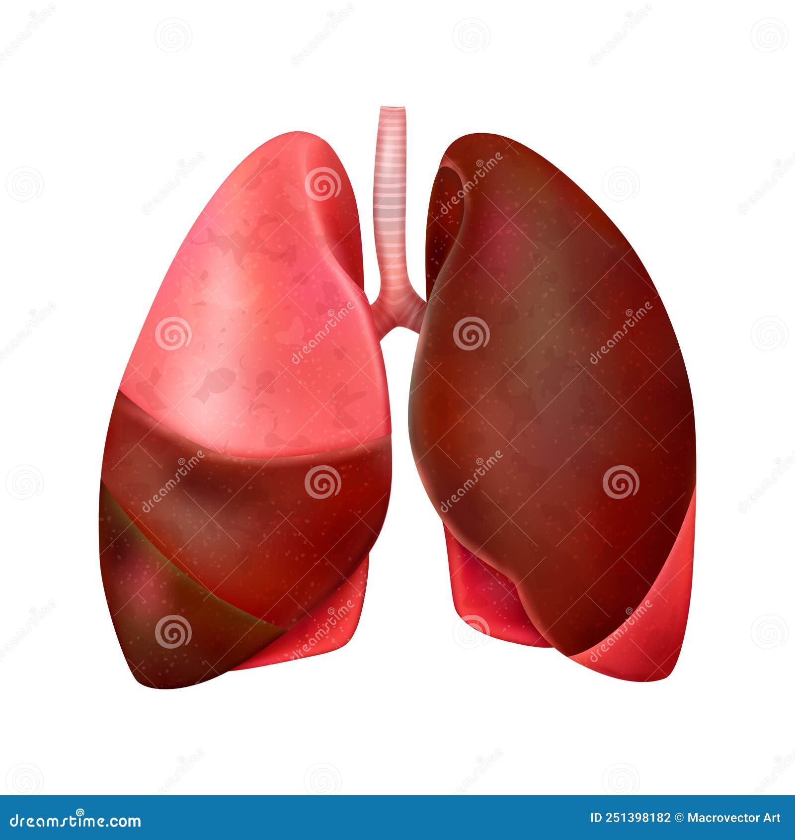 Realistic Damaged Lungs Composition Stock Vector - Illustration of ...