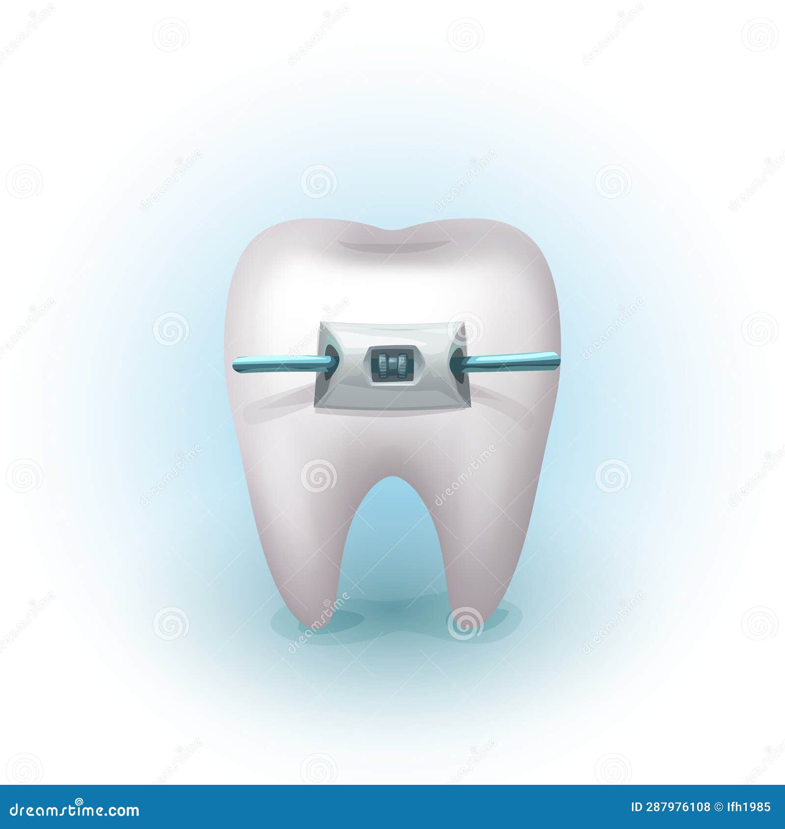 A Realistic Human White Tooth with Braces Stock Illustration ...