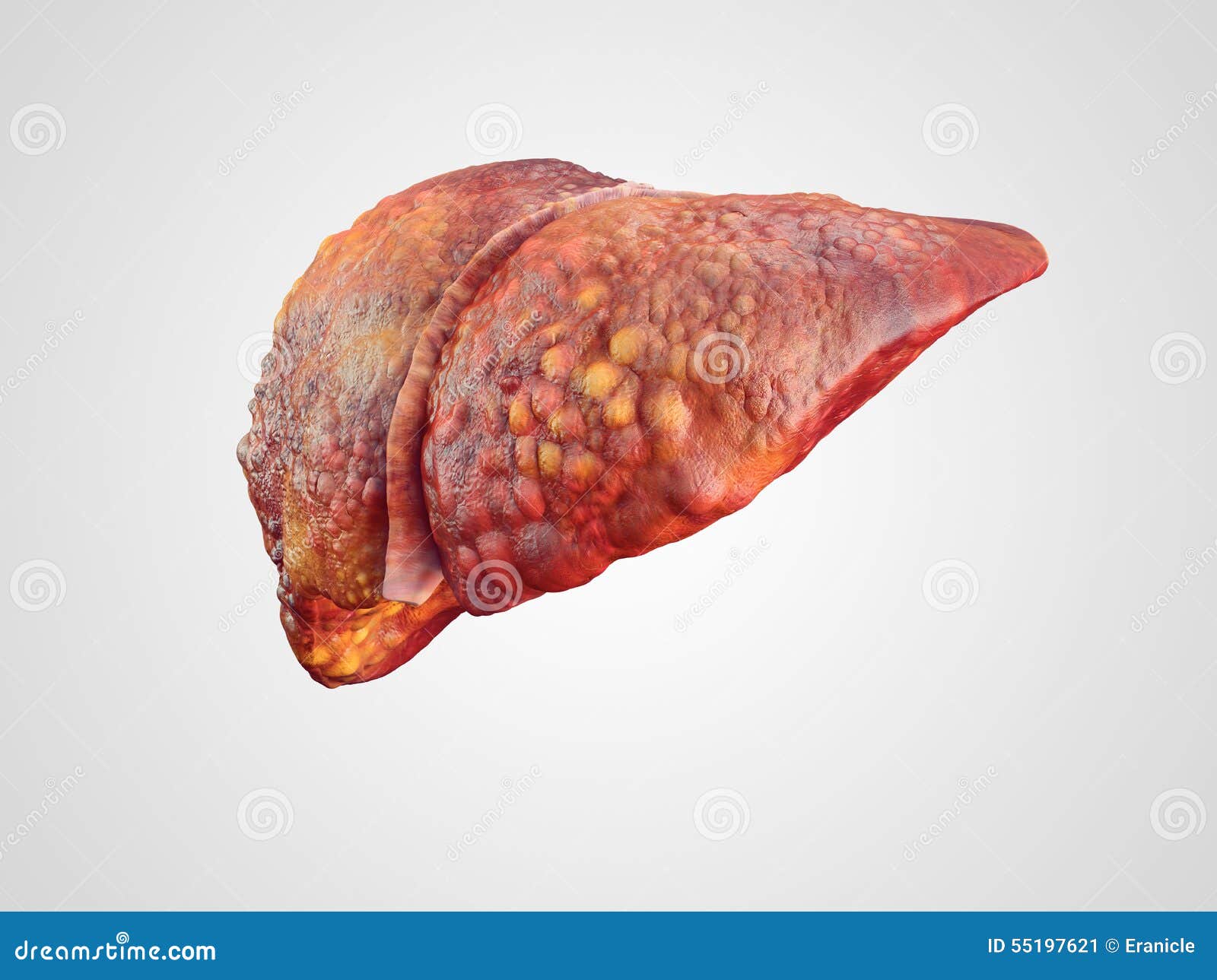 Human Liver Anatomy Closeup. Human Liver Anatomy Closeup. Realistic ...
