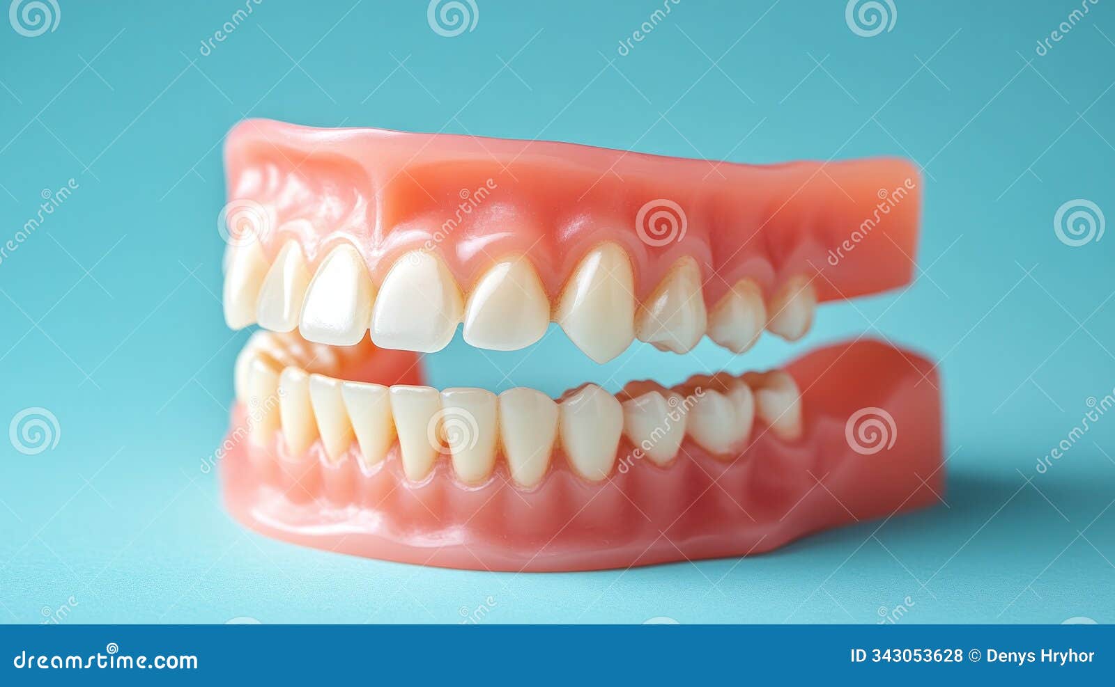 A Realistic Model of Dental Implants Illustrates Both Upper and Lower ...