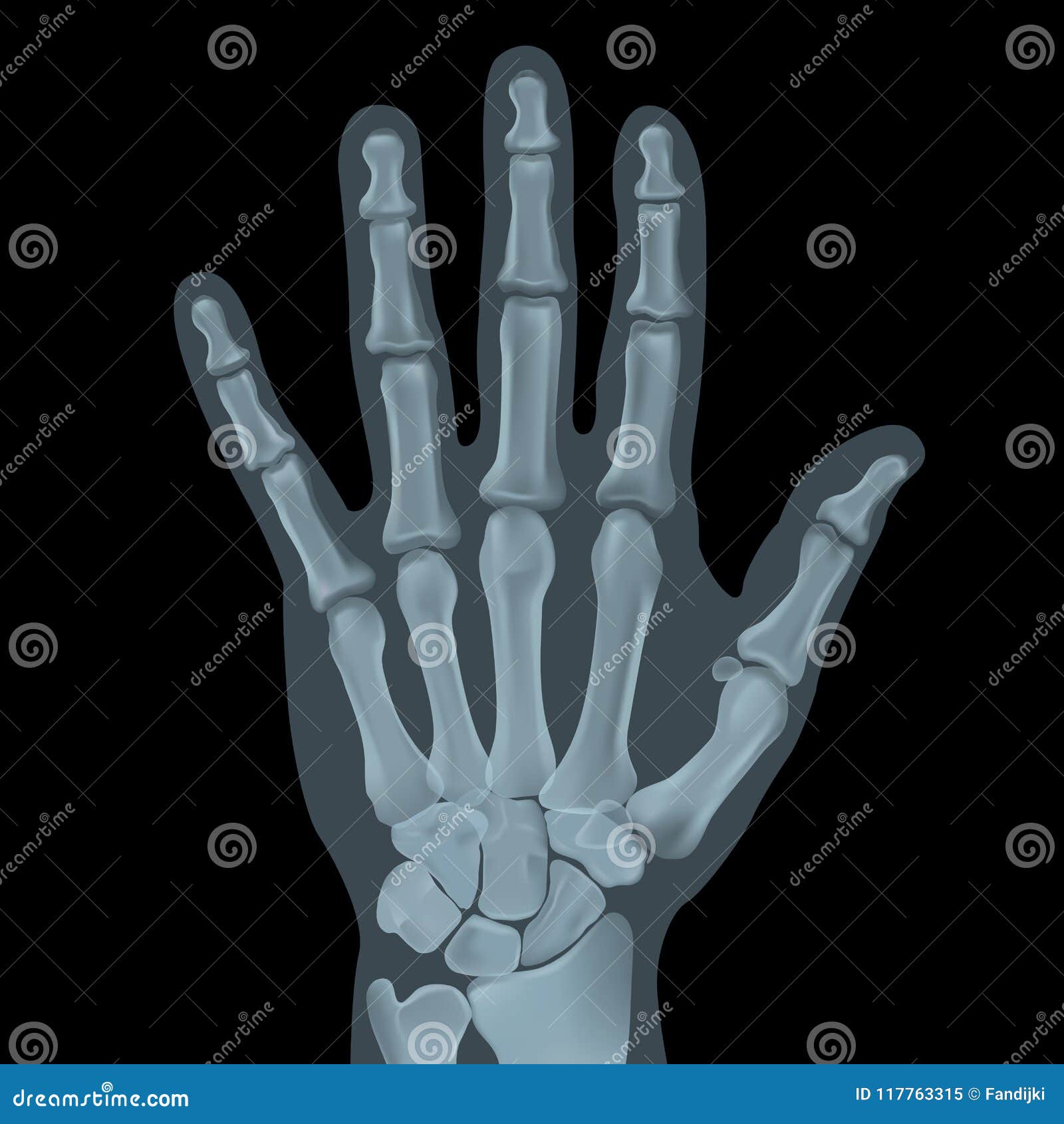 Realistic X-ray Shots.Image Uses a Grid Gradient Stock Vector ...