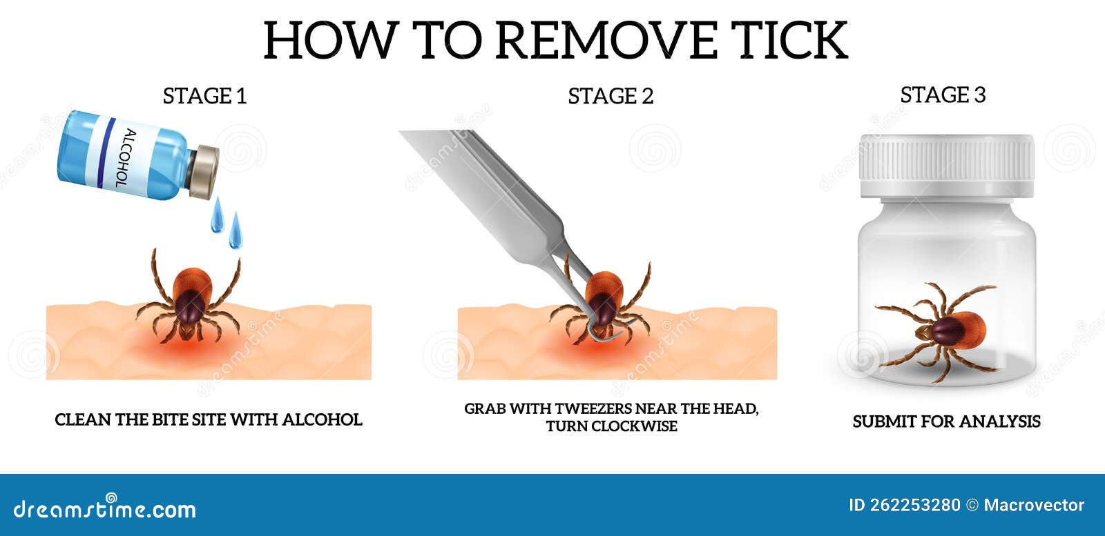 Realistic Spider Mite Remove Infographics Stock Vector - Illustration ...