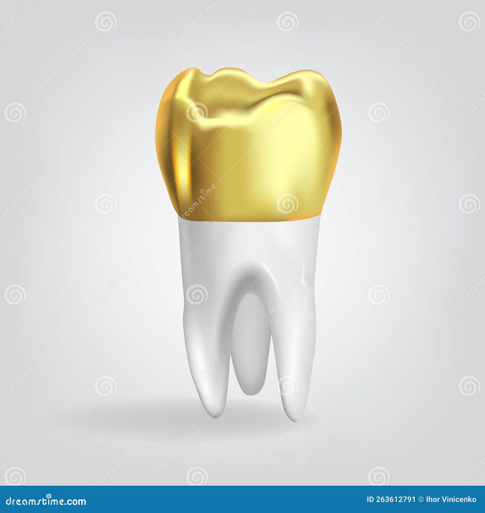 Realistic Tooth with Golden Crown. Stock Vector - Illustration of ...