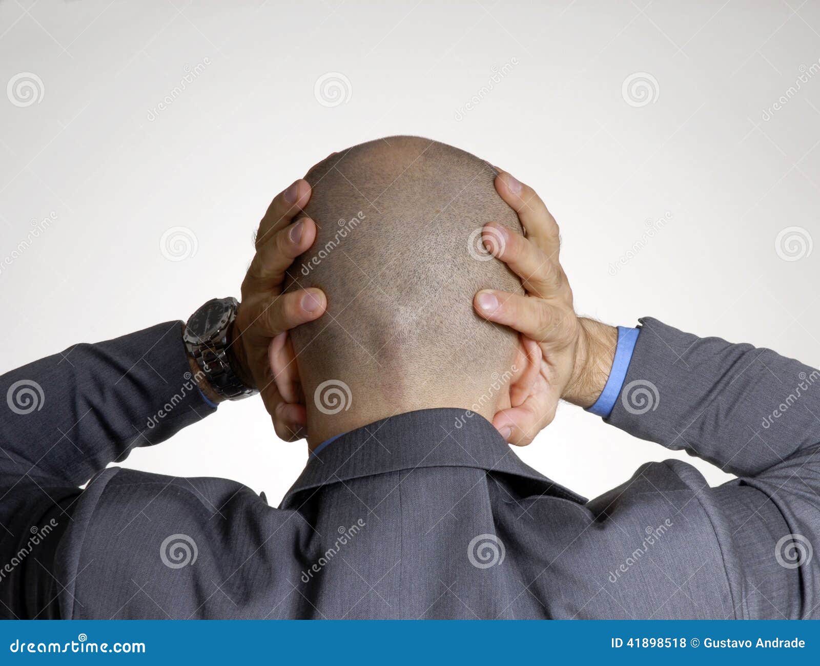 Rear view from a bald head stock photo. Image of problem - 41898518
