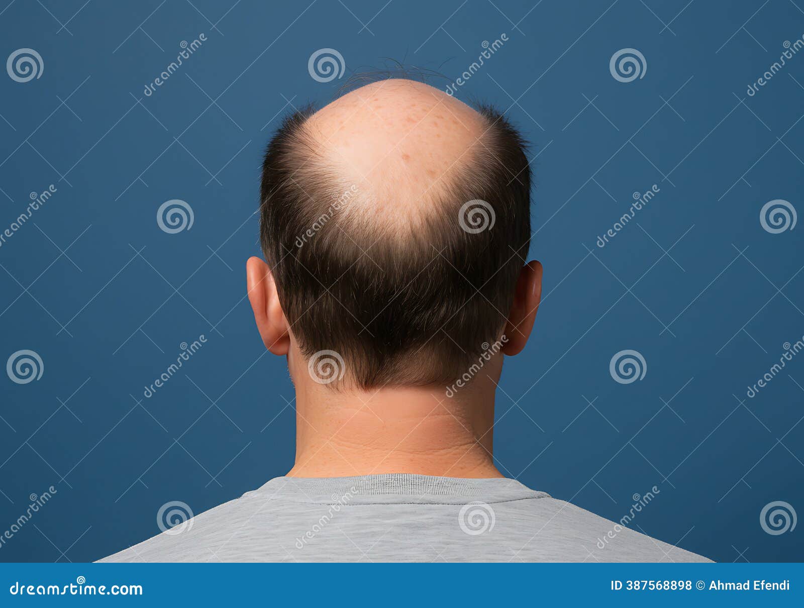 Male With A Receding Hairline In Black Suit Icon Stock Image ...