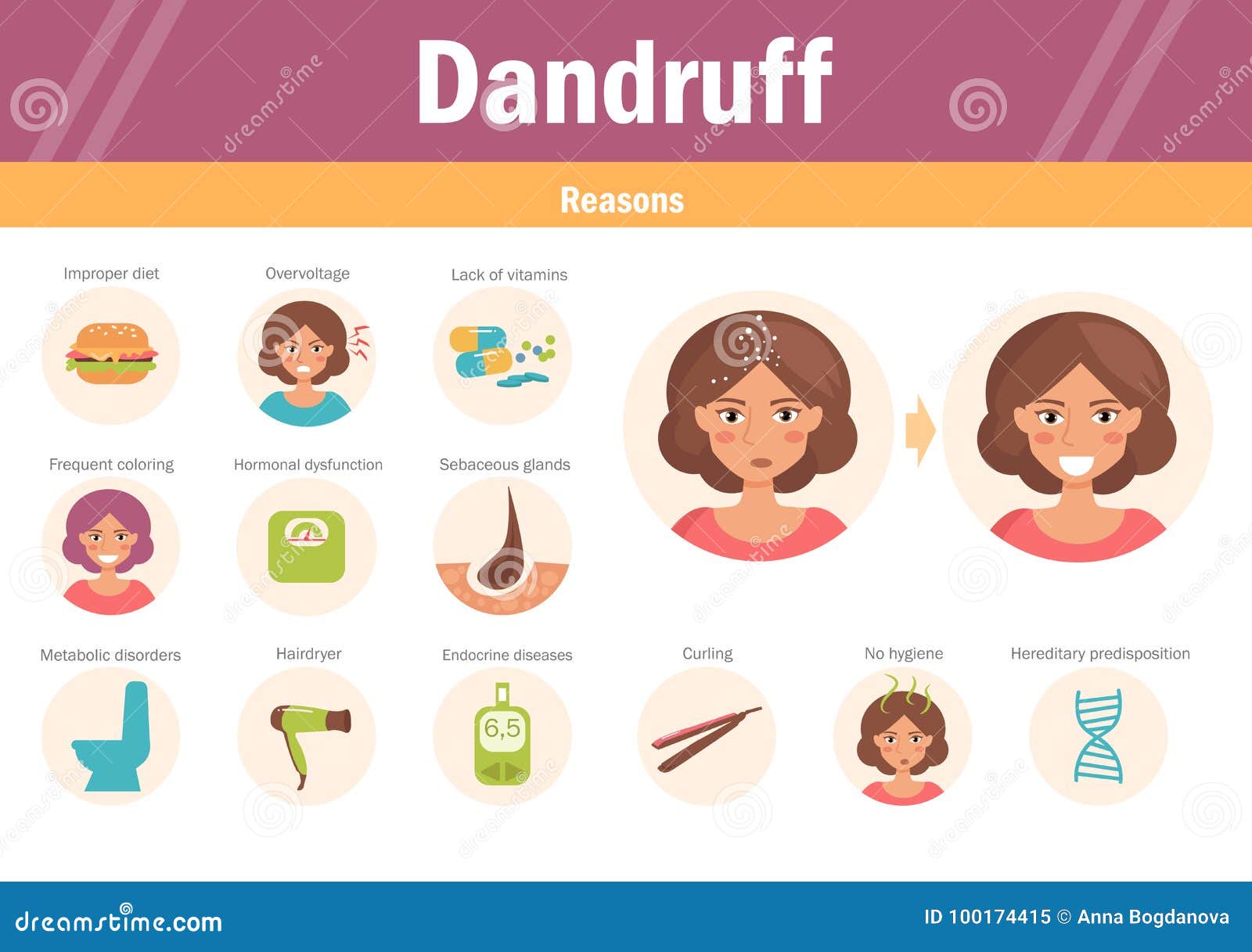 Reasons of Dandruff. Vector Stock Vector - Illustration of itchy ...