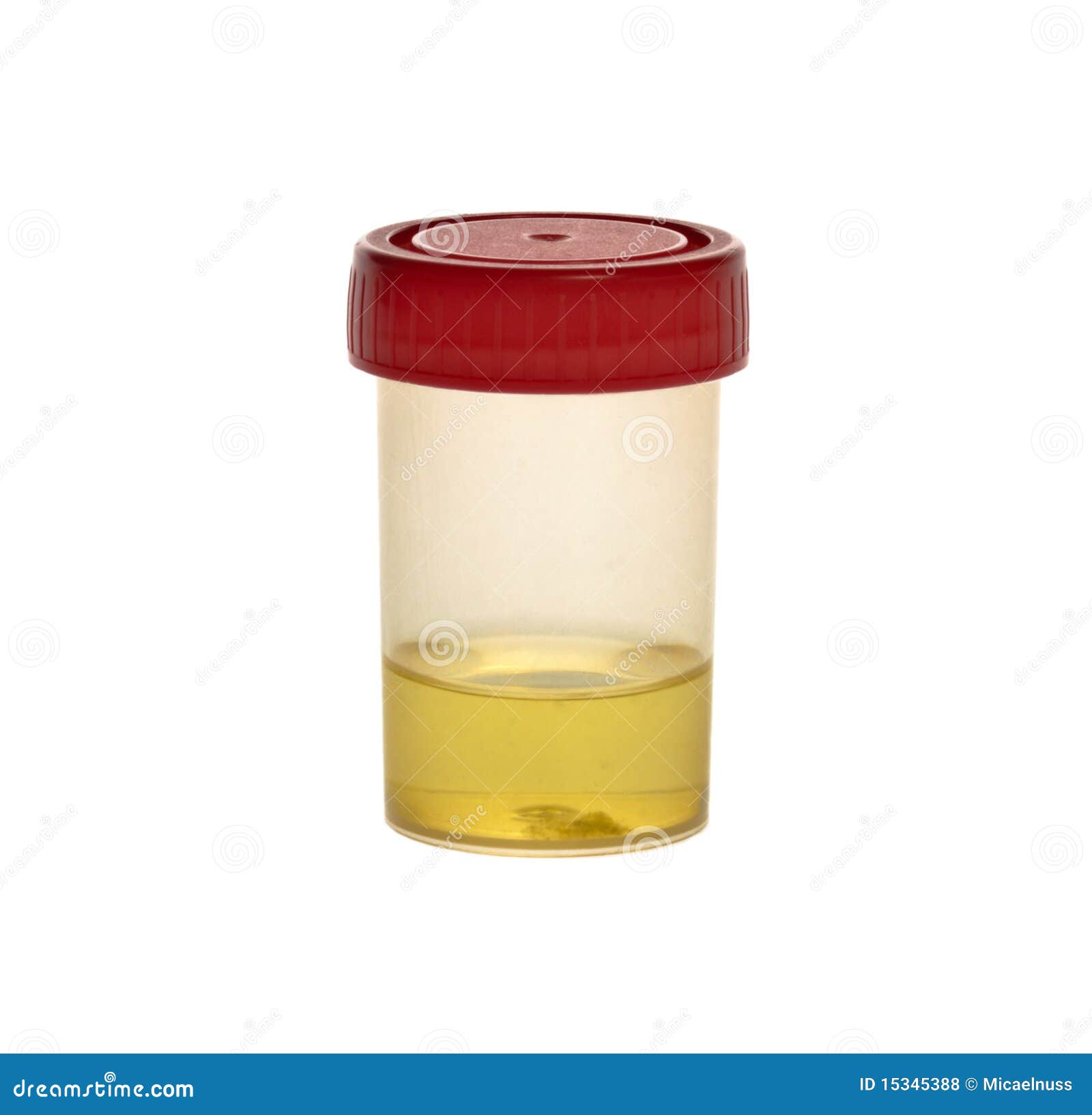 Recipiente da urina foto de stock. Imagem de médico, urina - 15345388