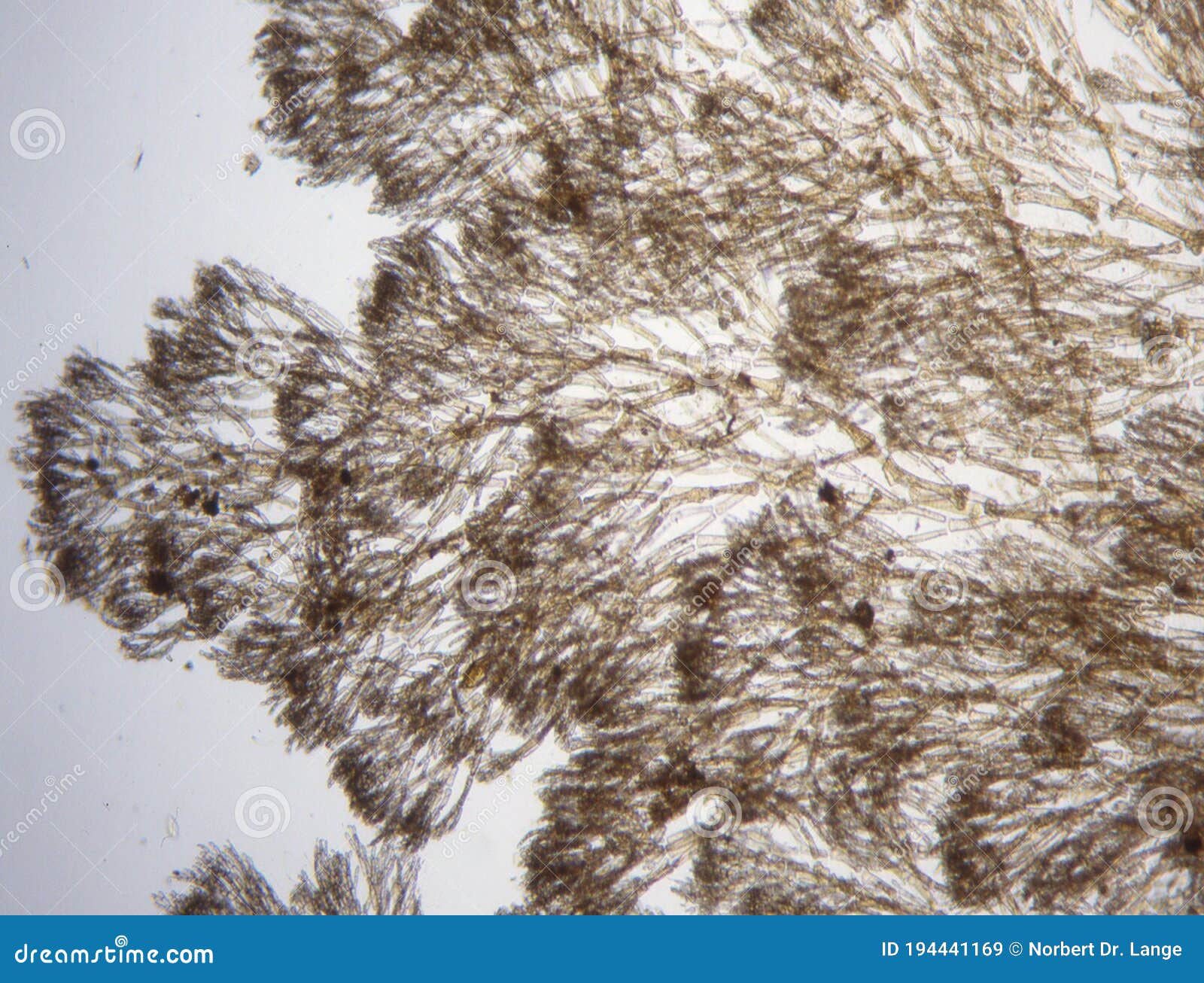 Red Algae Under The Microscope Royalty-Free Stock Photo | CartoonDealer ...