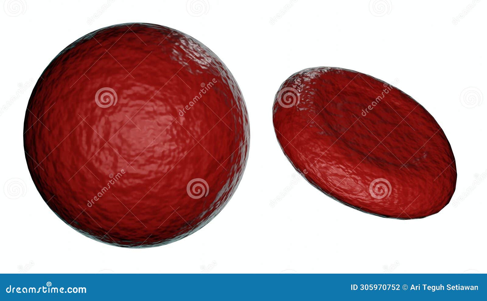 A Red Blood Cell (RBC) that is Spherical in Shape or Spherocyte Stock ...