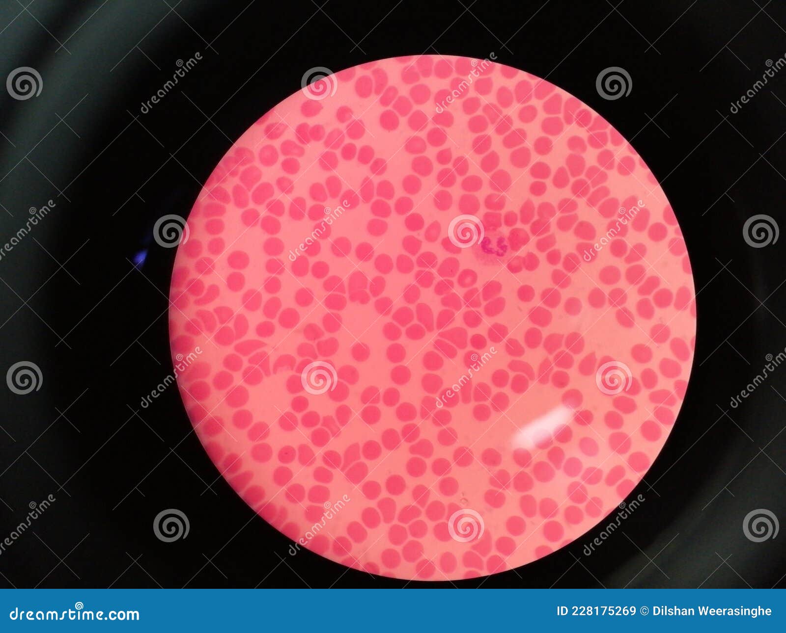 Red Blood Cell View on Microscope Stock Image - Image of universities ...