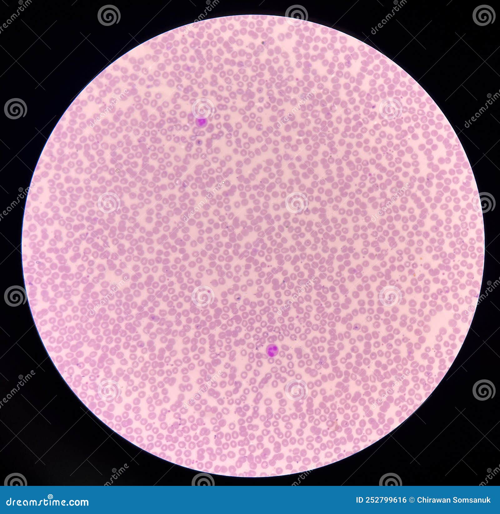 Red Blood Cell and White Blood Cells in 40X Microscope Stock Photo ...