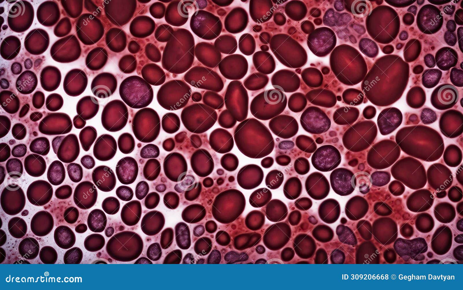 Red Blood Cells Background, Blood Wallpaper, Blood Background, Red ...