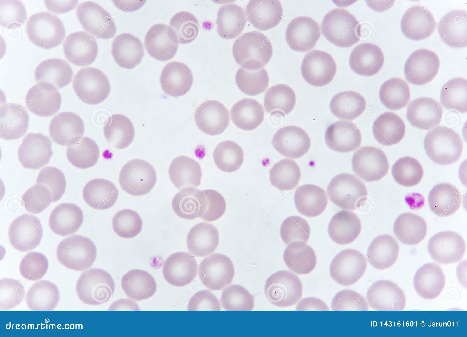 Red Blood Cells and Platelet in Blood Smear Stock Image - Image of ...