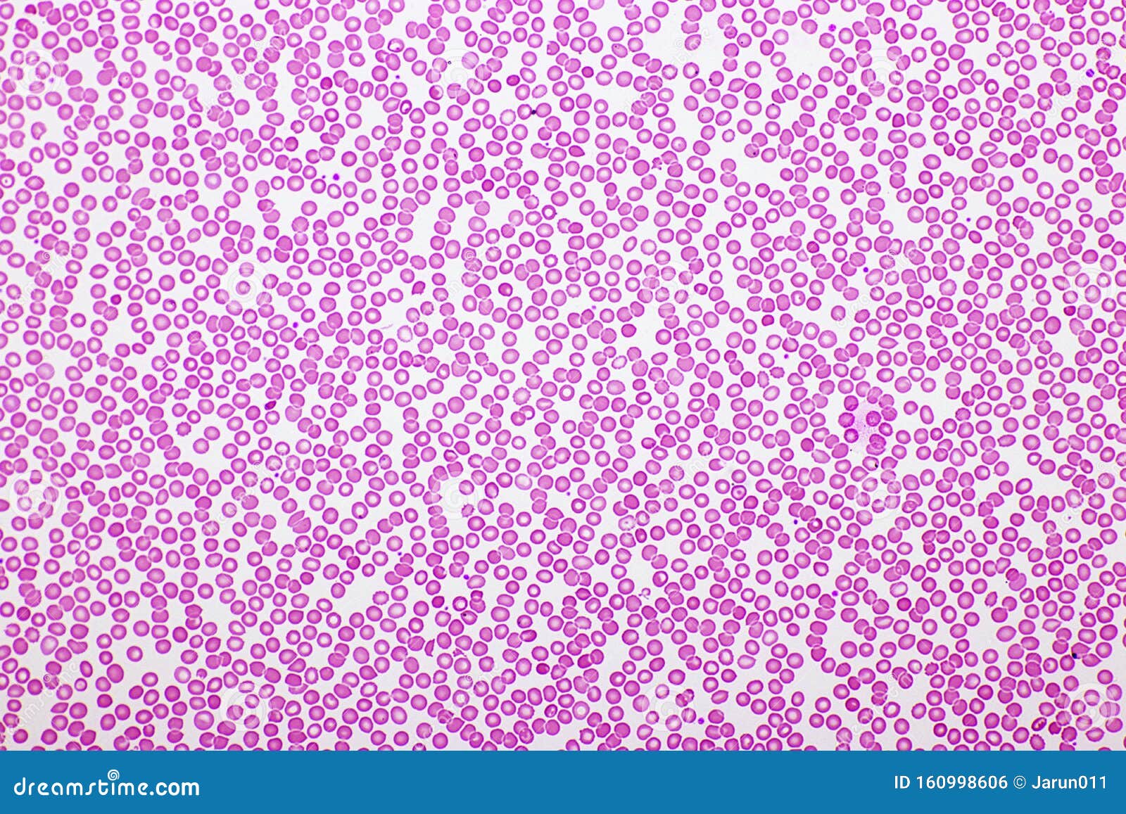 Red Blood Cells and Platelet in Blood Smear Stock Photo - Image of exam ...