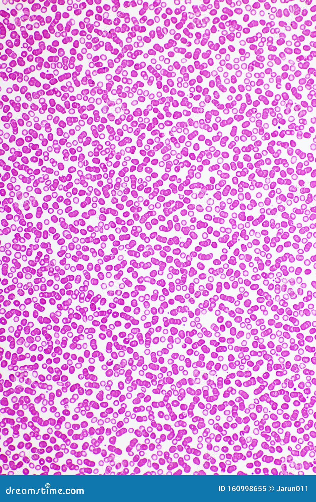 Red Blood Cells and Platelet in Blood Smear Stock Image - Image of exam ...