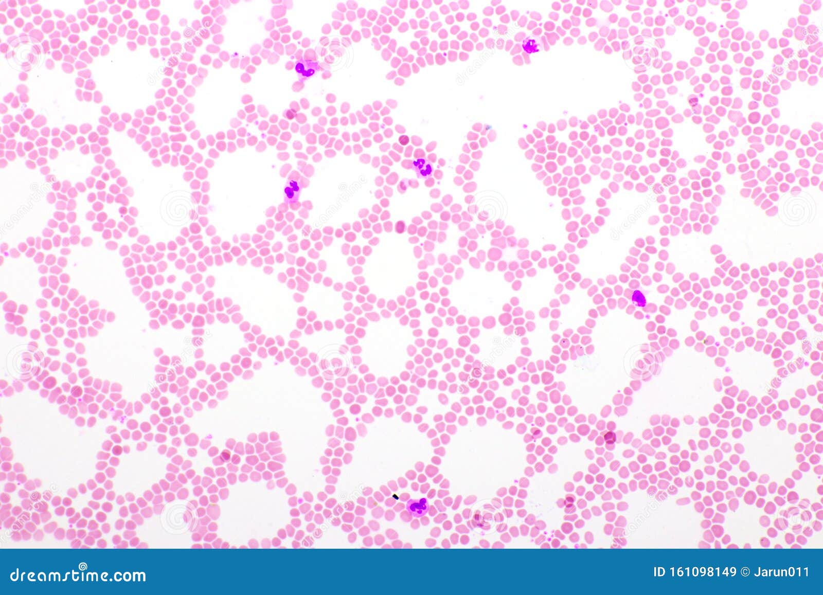 Red Blood Cells And Platelet In Blood Smear Royalty-Free Stock Photo ...