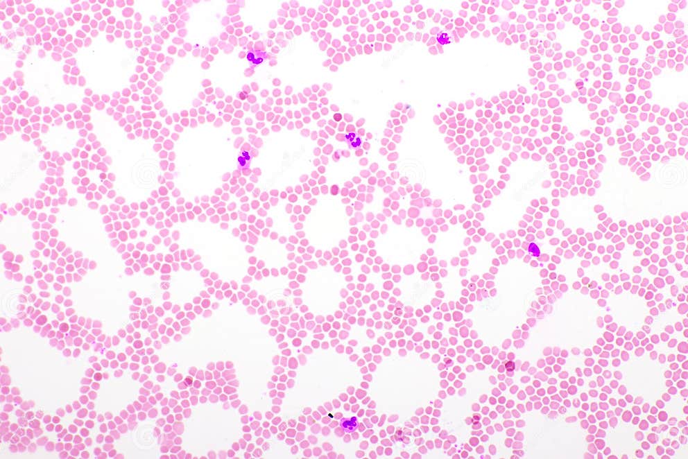 Red Blood Cells and Platelet in Blood Smear Stock Image - Image of ...