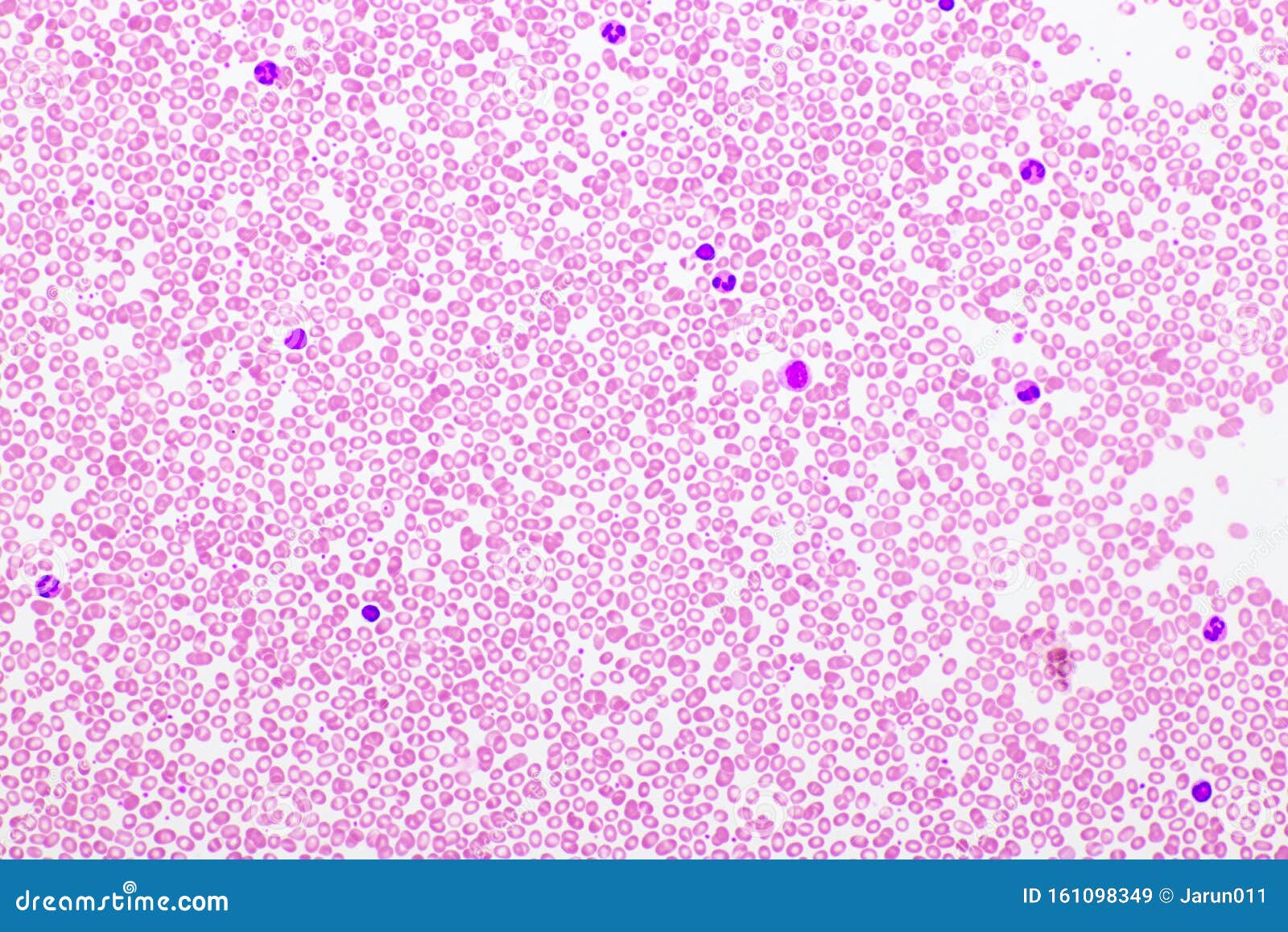 Red Blood Cells And Platelet In Blood Smear Royalty-Free Stock ...