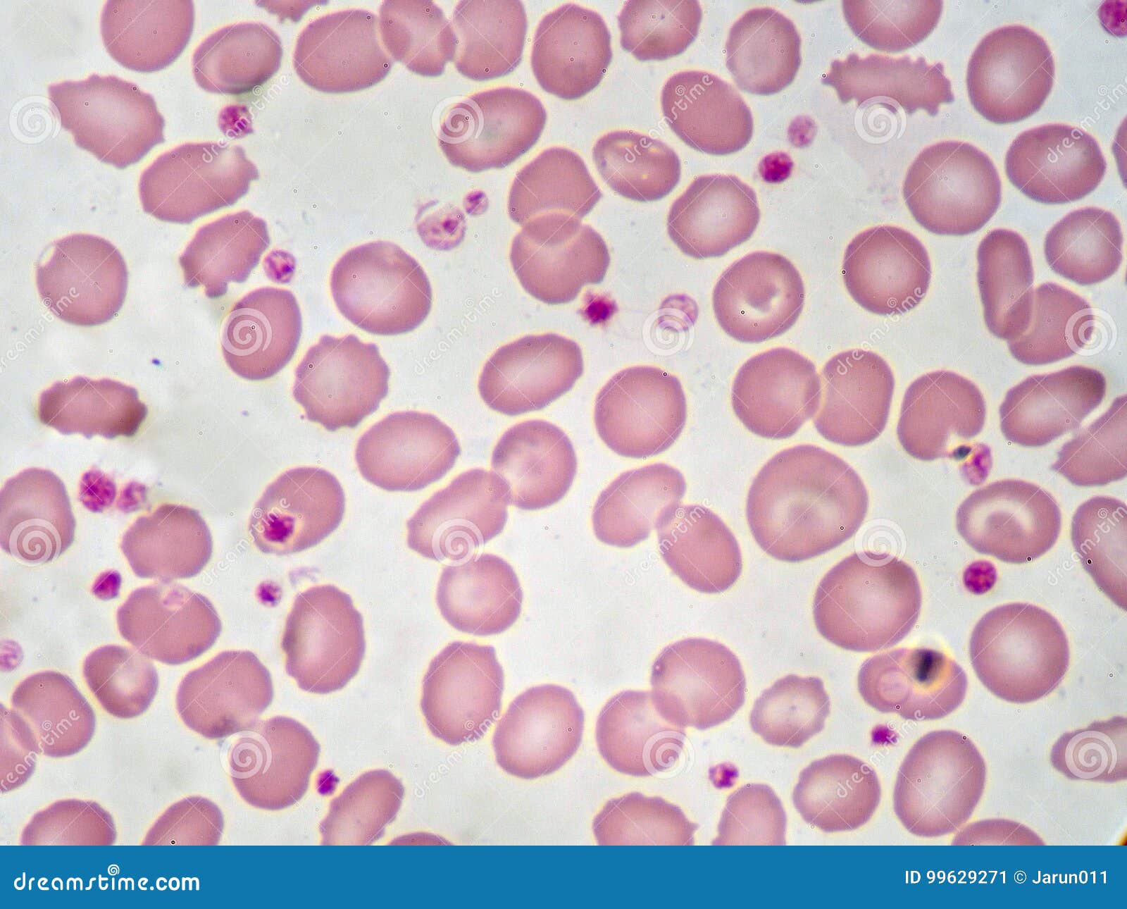 Red blood cells stock image. Image of microscope, experiment - 99629271