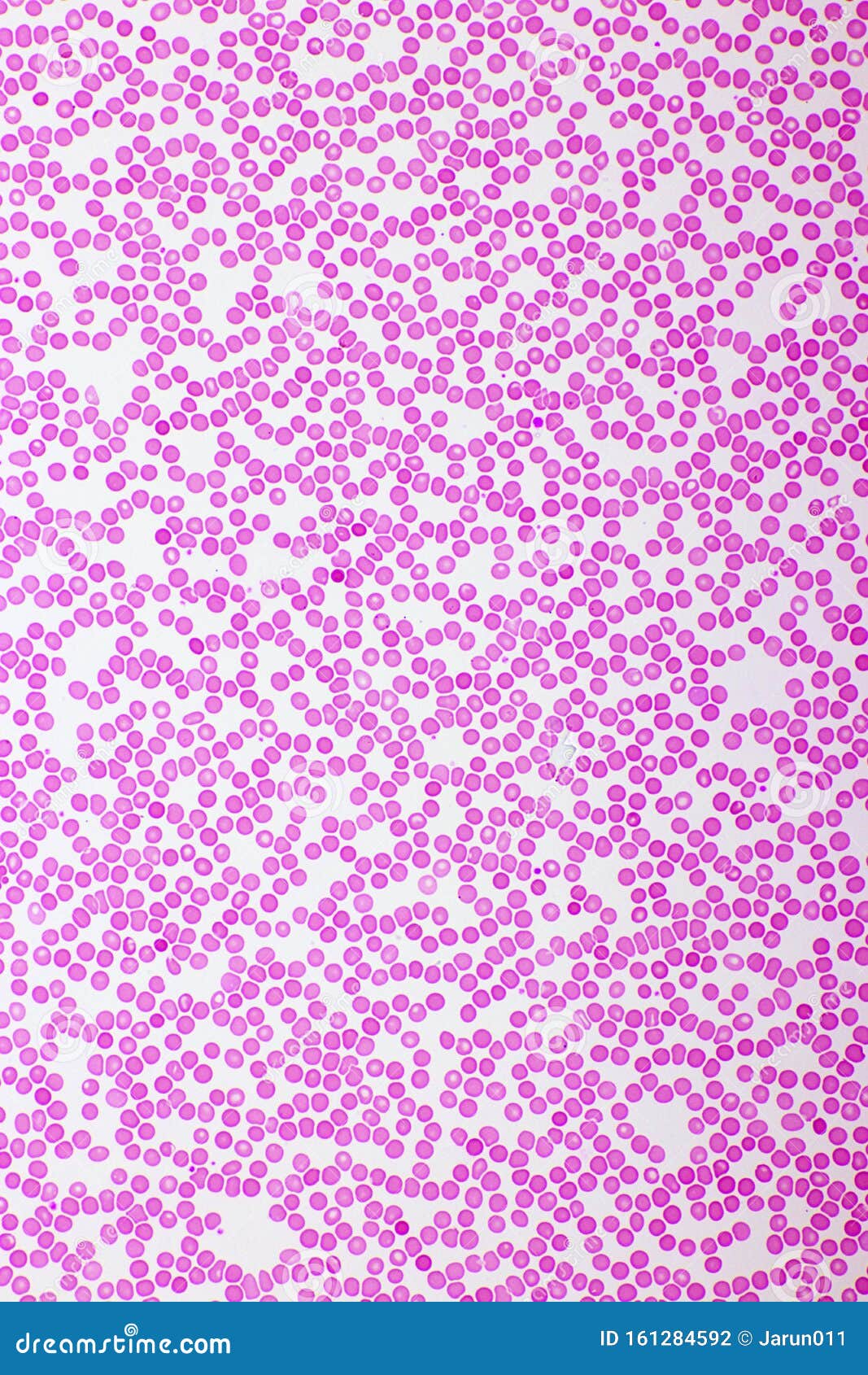 Red Blood Cells in Blood Smear Stock Photo - Image of examination ...