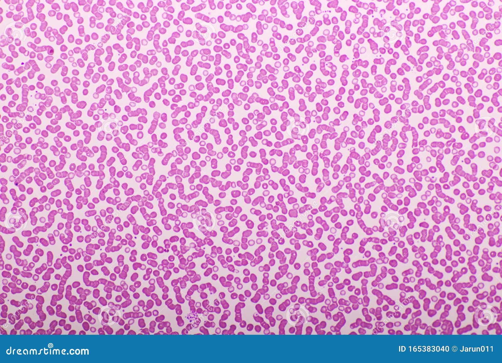 Red Blood Cells in Blood Smear Stock Photo - Image of 400x, examination ...