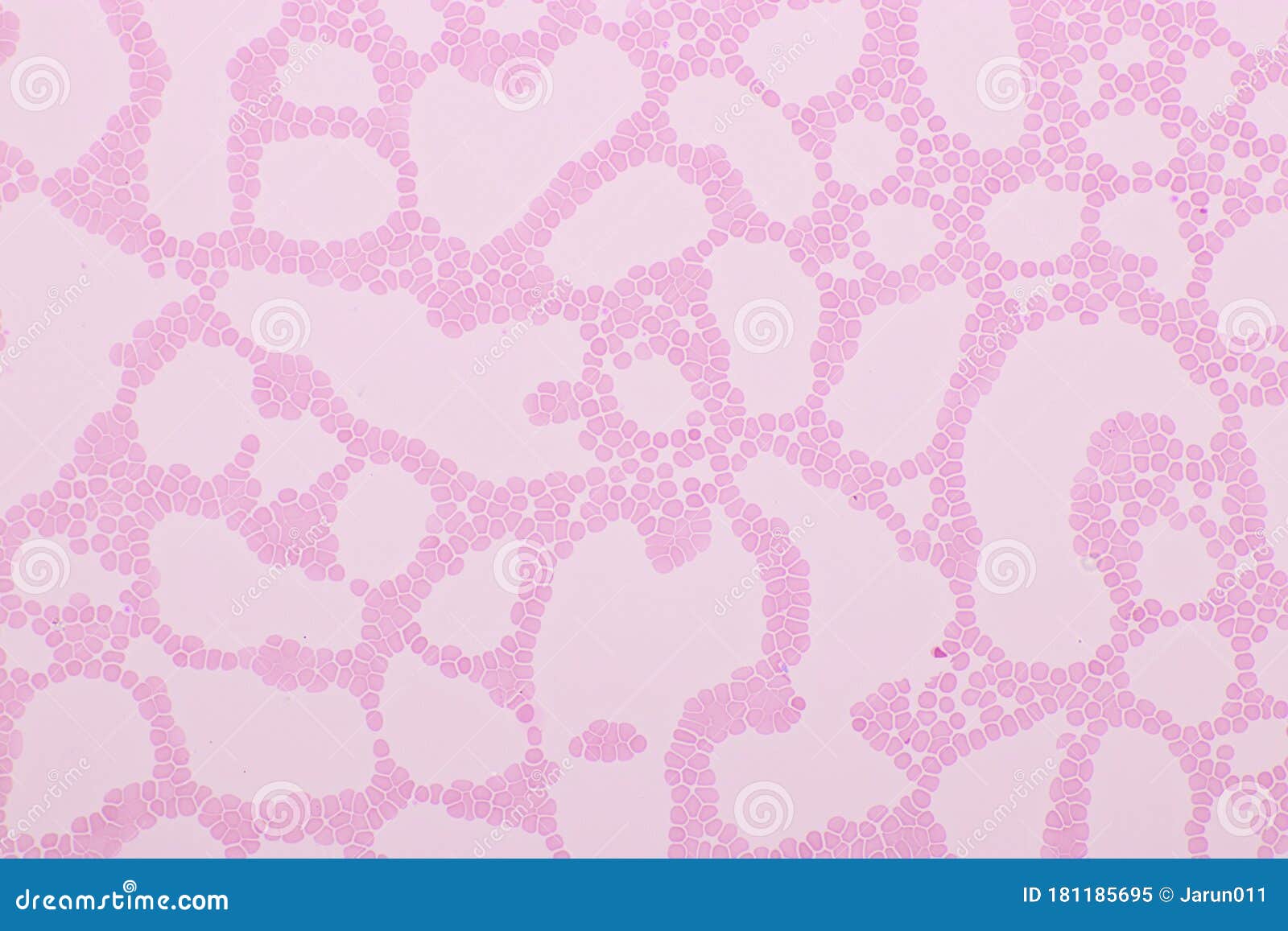 Red Blood Cells in Blood Smear Stock Image - Image of erythrocyte ...