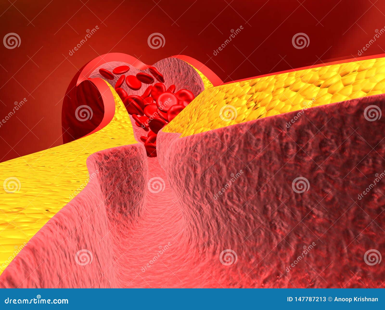 Red Blood Cells with Wain stock illustration. Illustration of ...