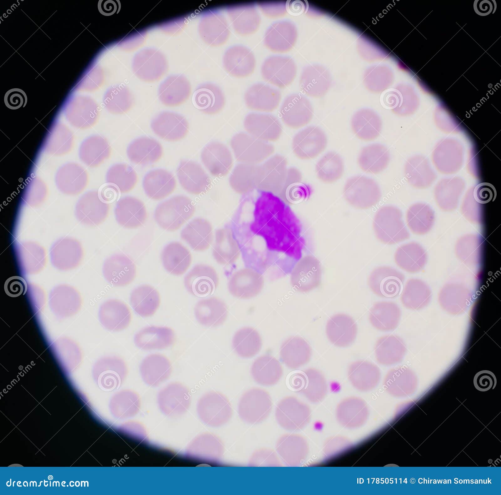 Red Blood Cells and White Blood Cells Background Stock Photo - Image of ...
