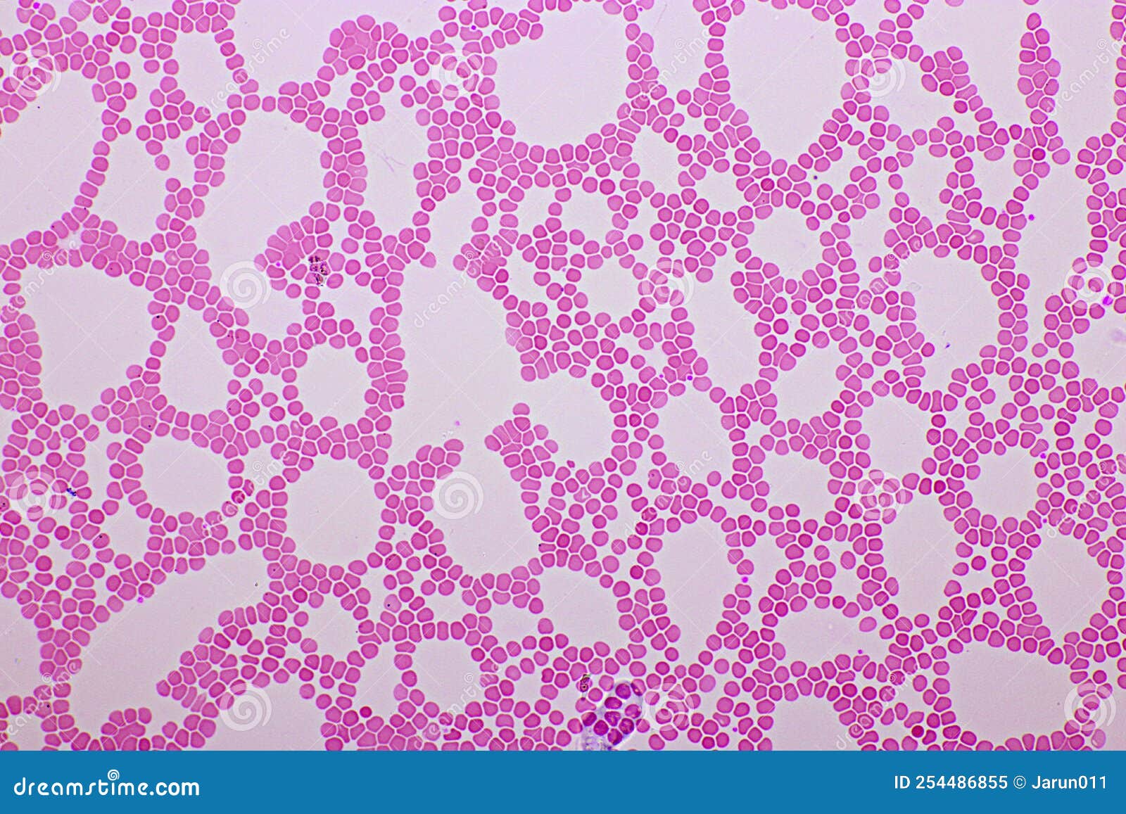 Red Blood Cells and White Blood Cells in Blood Smear Stock Image ...