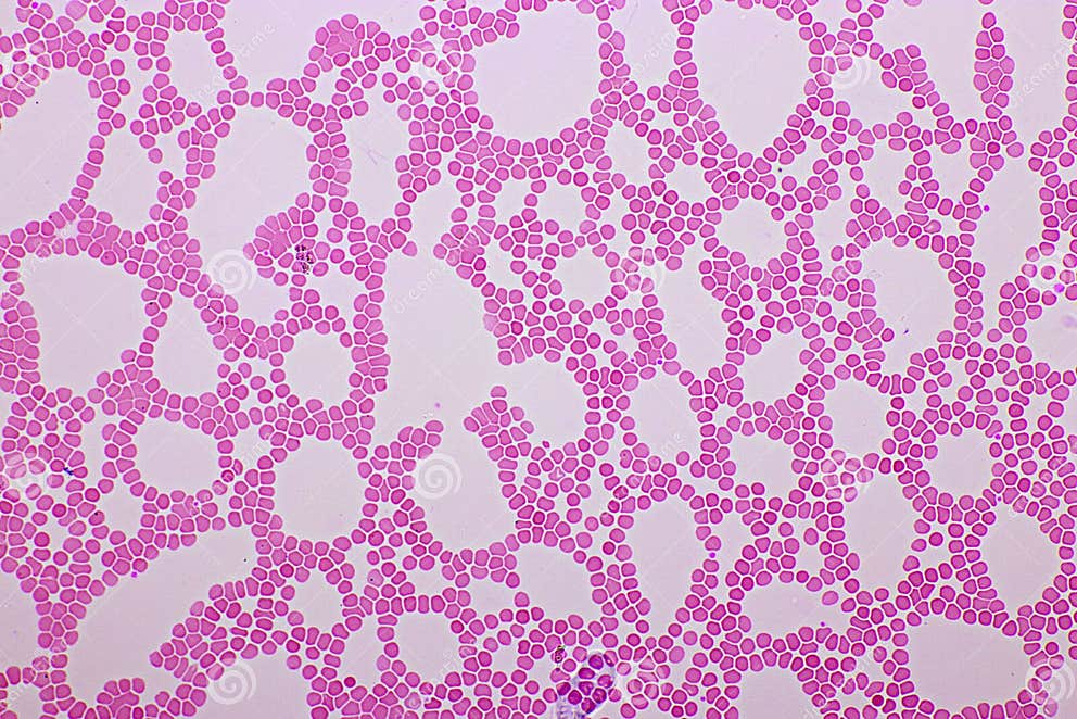 Red Blood Cells and White Blood Cells in Blood Smear Stock Image ...