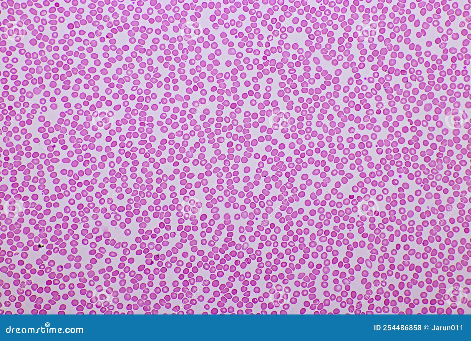 Red Blood Cells and White Blood Cells in Blood Smear Stock Photo ...