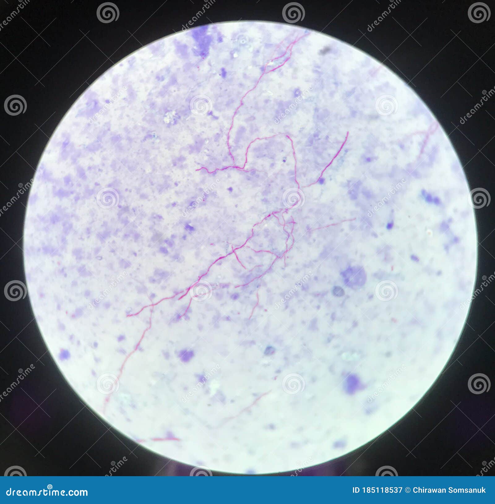 Red Branching Mycobacterium Tuberculosis on Blue Background in Modified ...