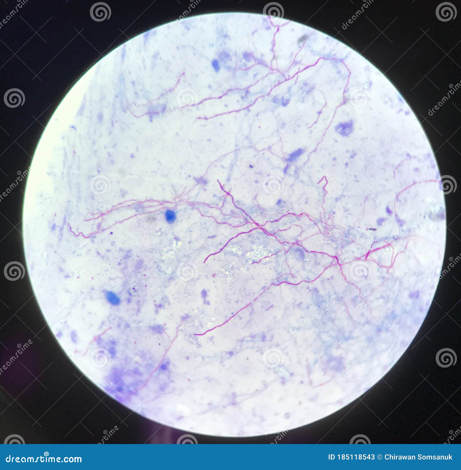 Red Branching Mycobacterium Tuberculosis on Blue Background in Modified ...