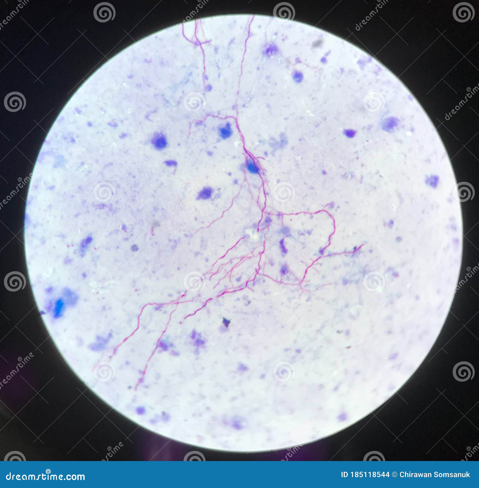Red Branching Mycobacterium Tuberculosis on Blue Background in Modified ...